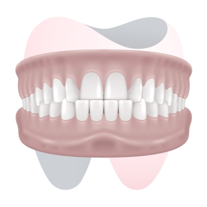 Condition Underbite - Clear Path Orthodontics